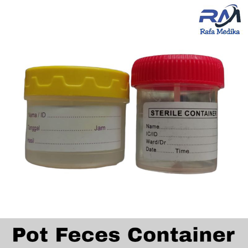 Jual Sample Container Pot Urine Pot Urin | Shopee Indonesia