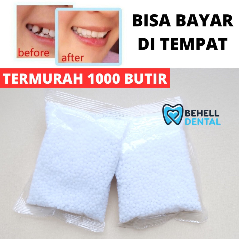 Jual TERMURAH !! 1000 BUTIR TEMPTOOTH GIGI PALSU SEMENTARA PENAMBAL ...