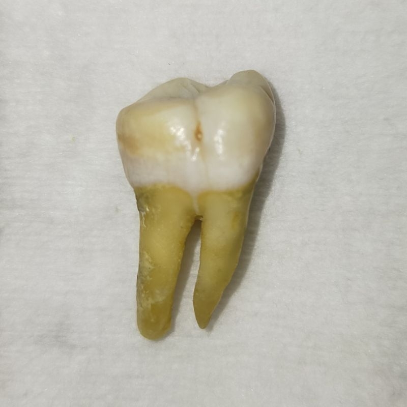 Jual Gigi praktikum molar rahang bawah/gigi ART/penambalan/gigi asli ...