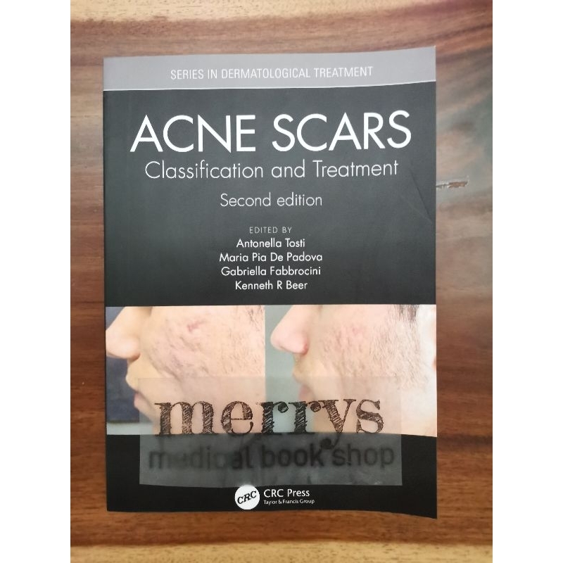 Jual [Full Color] Acne Scars Classification and Treatment 2nd Edition ...