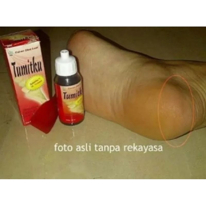 Jual TUMITKU 30 ml | Shopee Indonesia