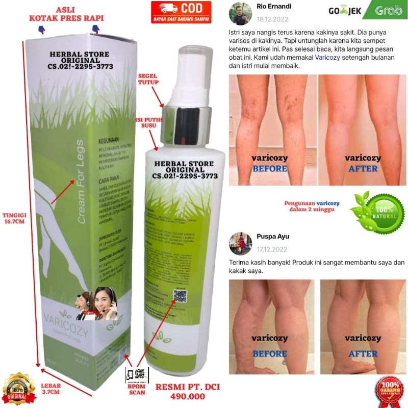 Jual VARICOZY KRIM ASLI ORIGINAL OBAT VARISES OBAT URAT MENONJOL BPOM ...