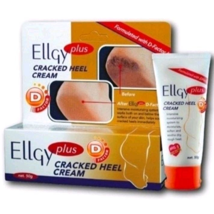 Jual ELLGY Plus D Factor Cracked Heel Cream (50g) | Shopee Indonesia