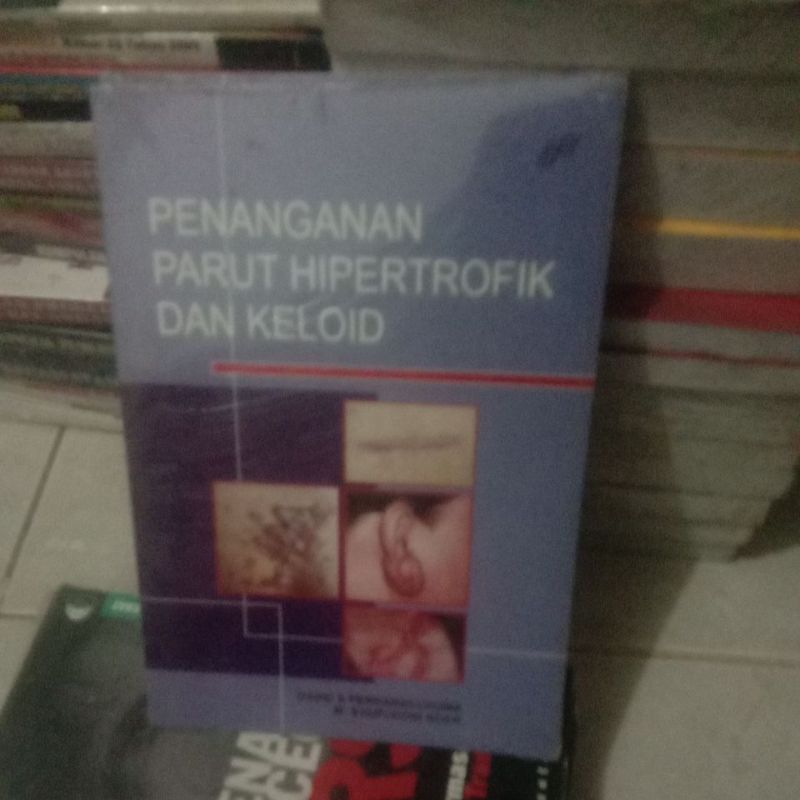 Jual buku penanganan parut hipertrofik dan keloid | Shopee Indonesia