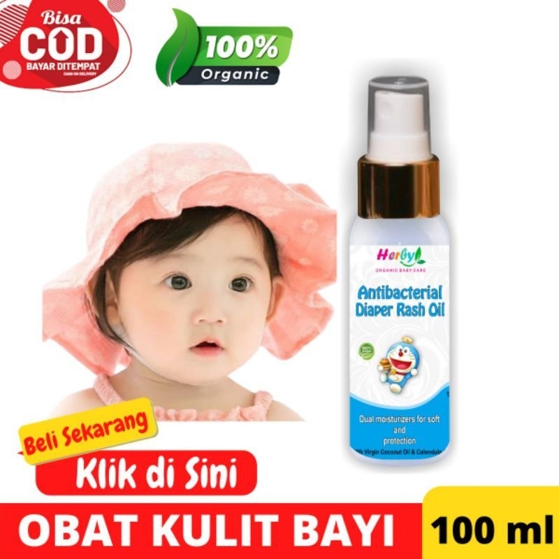 Jual Obat Iritasi Kulit Bintik Merah Bruntusan Gatal Baby Bayi Anak ...