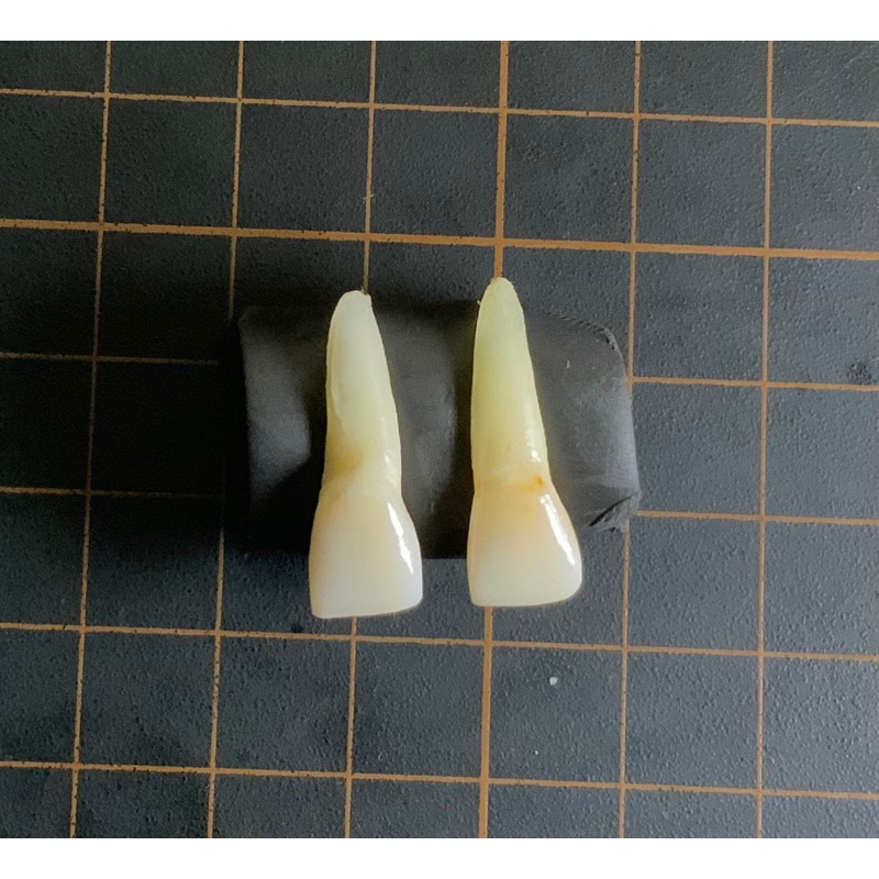 Jual Gigi Praktikum Insisivus 1/ Central [21] ENDO, Regio 2 | Shopee ...