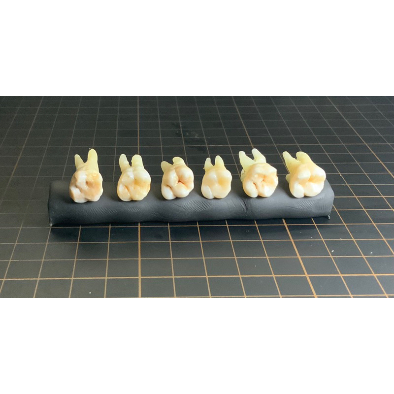 Jual Gigi praktikum Molar 1 [16] Endo/Resto | Shopee Indonesia