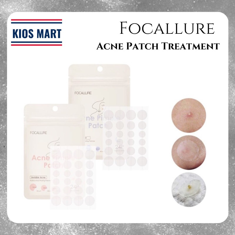 Jual Focallure Spot Acne Patch Treatment Day/Night Waterproof Smooth ...