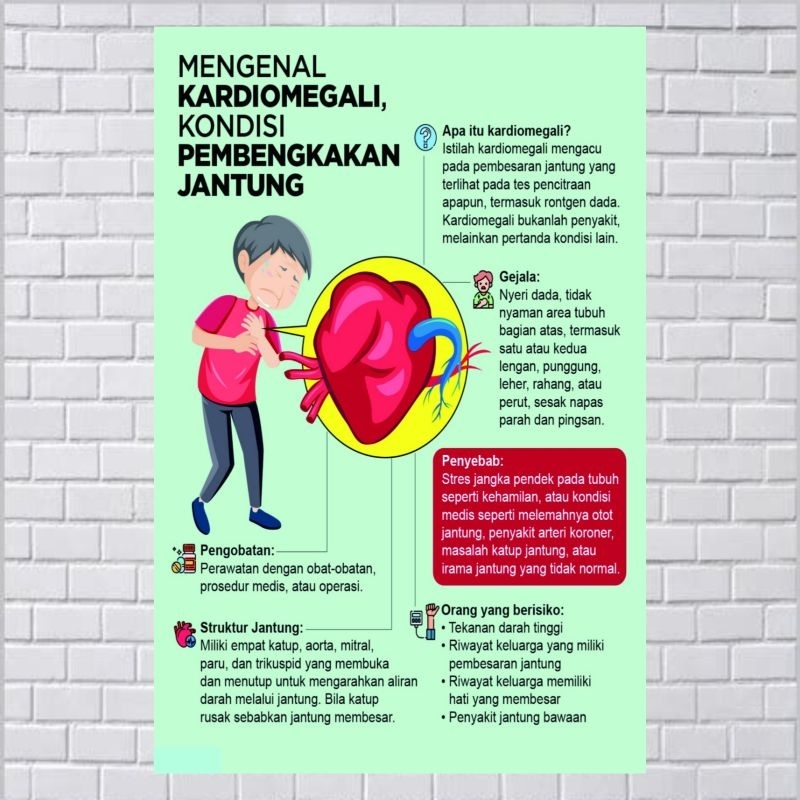 Jual Poster Kesehatan Kardiomegali, Pembengkakan Jantung | Shopee Indonesia