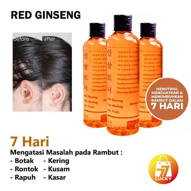 Jual Red Ginseng Hair Tonic Rambut Rontok Parah Vitamin Rambut ...