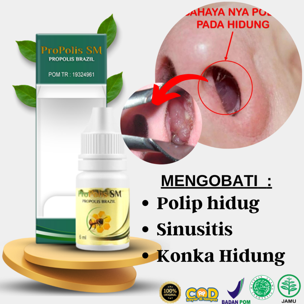 Jual Obat Sinusitis, Polip Hidung, Rhinitis, Alergi Sinus, Hidung Bau Busuk, Hidung Berlendir ...