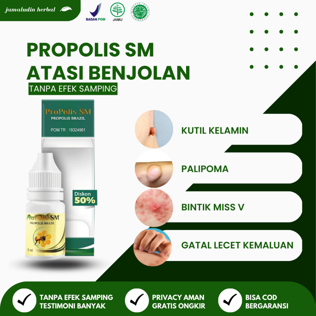 Jual Propolis SM - Propolis Brazilian ORIGINAL - Obat Kelenjar Getah ...