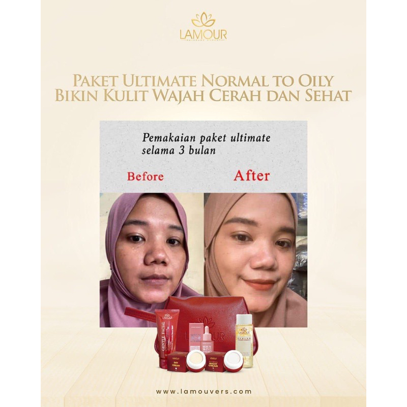 Jual [LAMOUR] PAKET ULTIMATE NORMAL | Shopee Indonesia