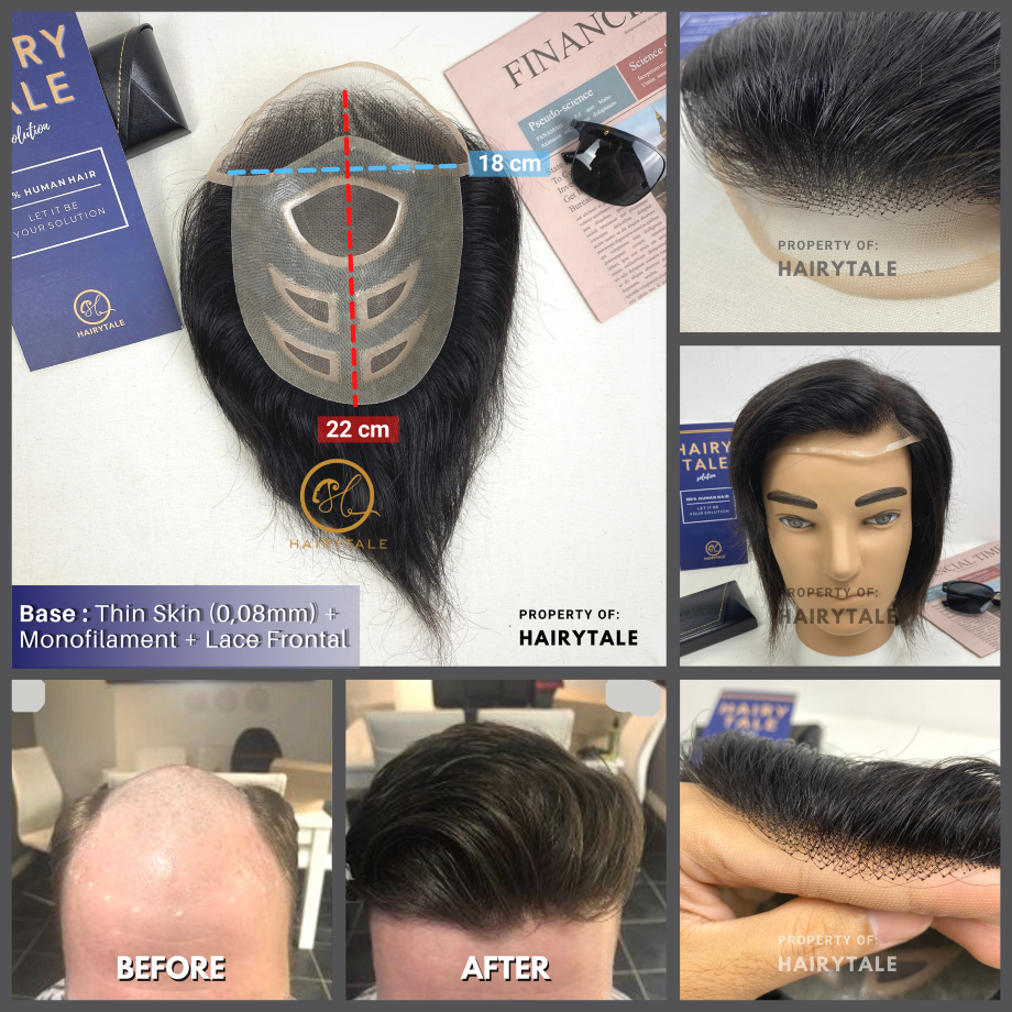 Jual Toupee / tutup botak pria, Thin skin + Mono + Front lace, custom ...