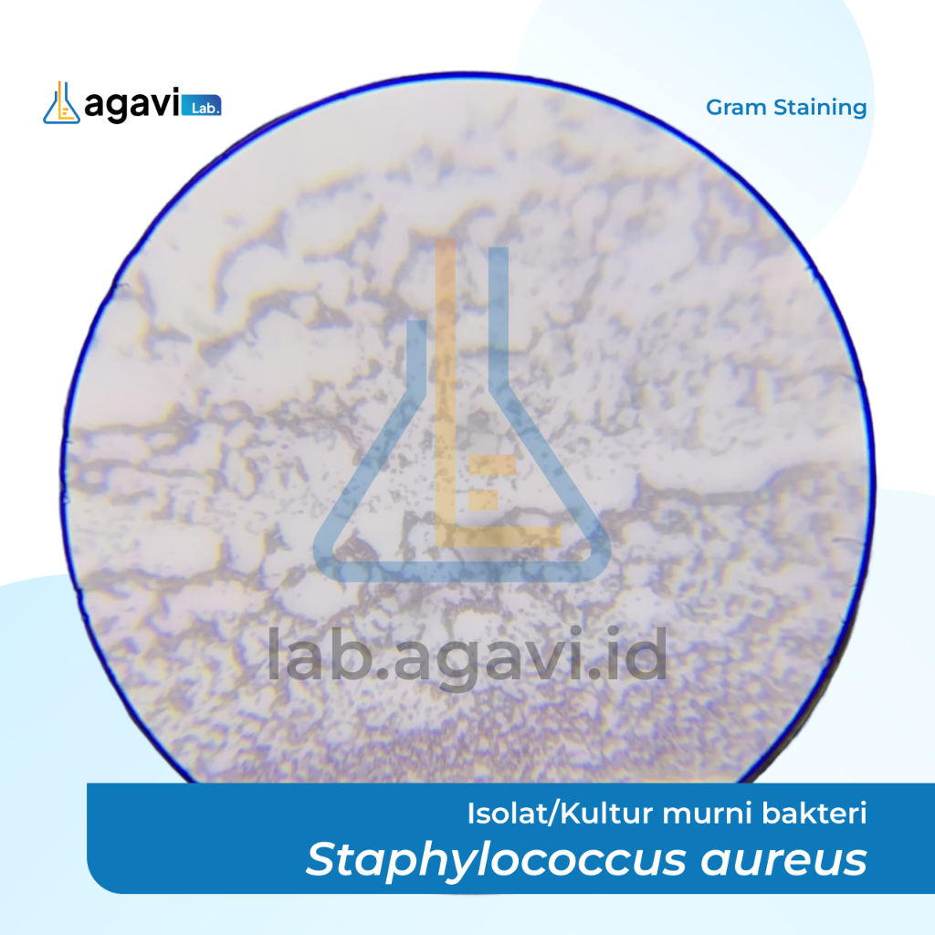 Jual Isolat/Kultur Murni Bakteri Staphylococcus aureus ATCC 6538P PK/5 ...