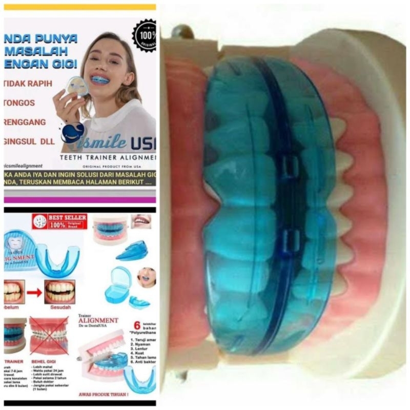 Jual Perapi Perapih Gigi Teeth Trainer Alignment | Shopee Indonesia