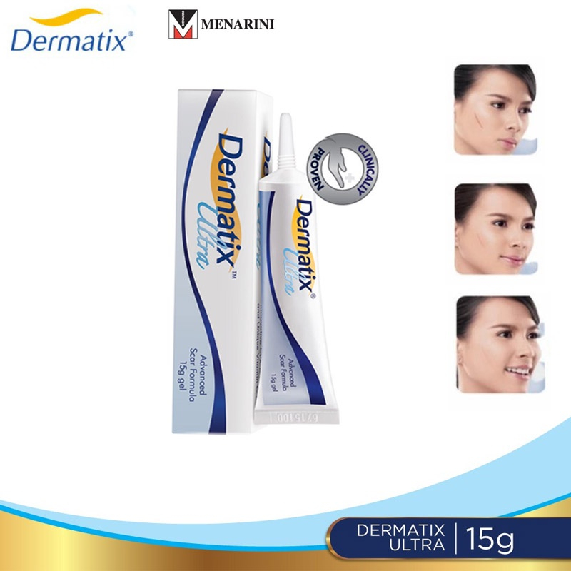 Jual Dermatix Ultra Gel 15gr Advanced Scar Formula Gel LKrim Penghilang ...