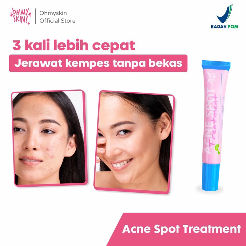 Jual OH MY SKIN Acne Spot Treatment | Shopee Indonesia