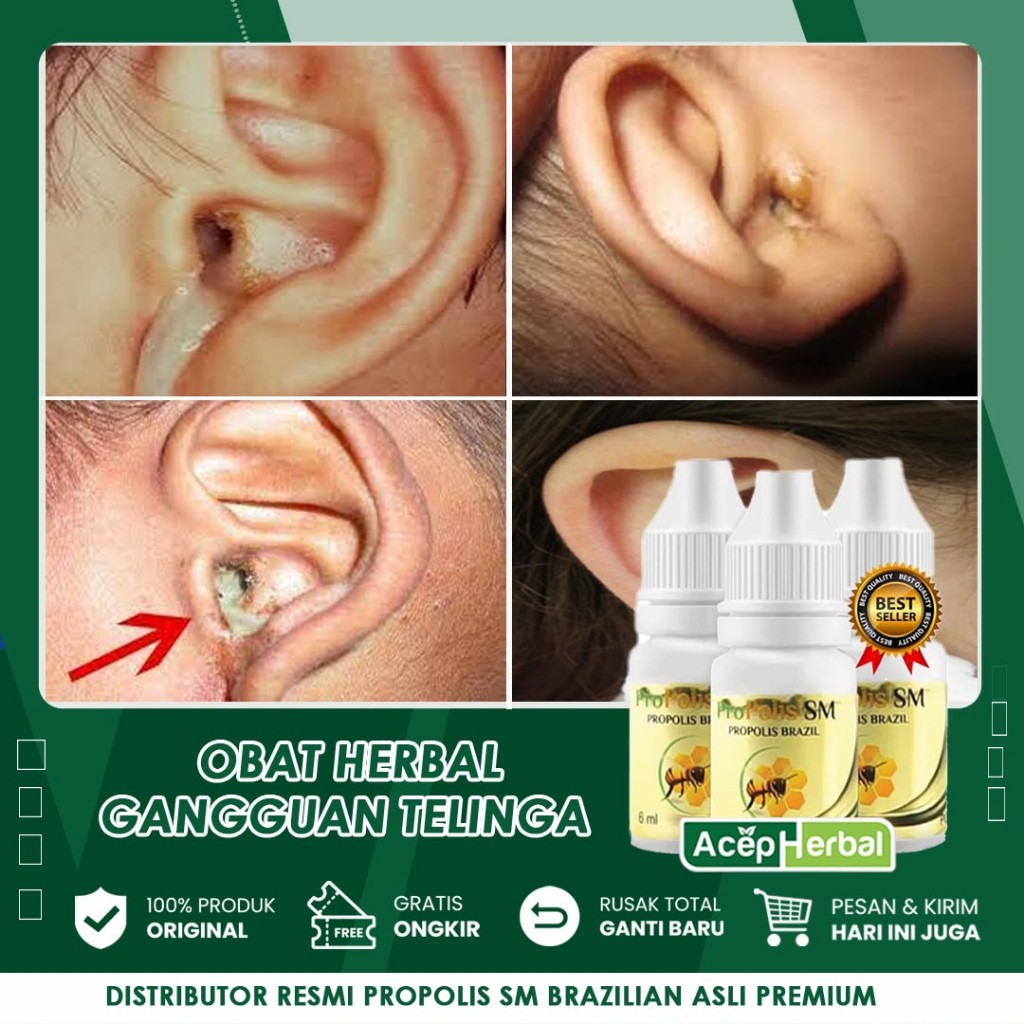 Jual Obat Tetes Telinga Congek Bernanah Bau Busuk Telinga Gatal Berair ...