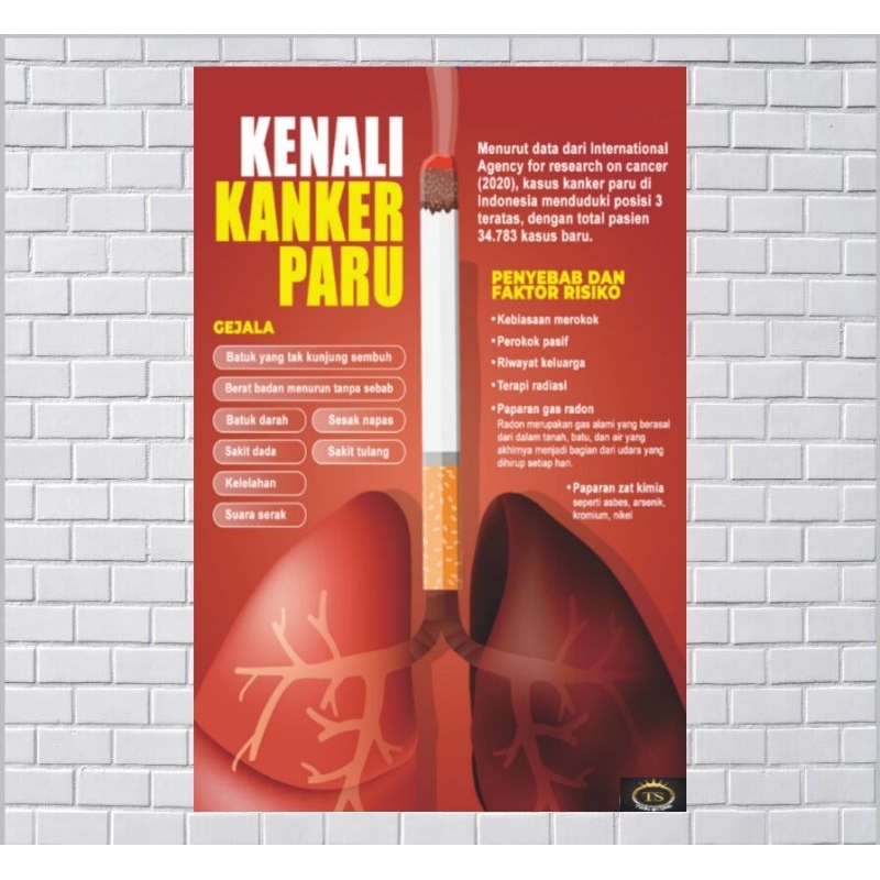 Jual Poster Kesehatan Kenali Kanker Paru | Shopee Indonesia