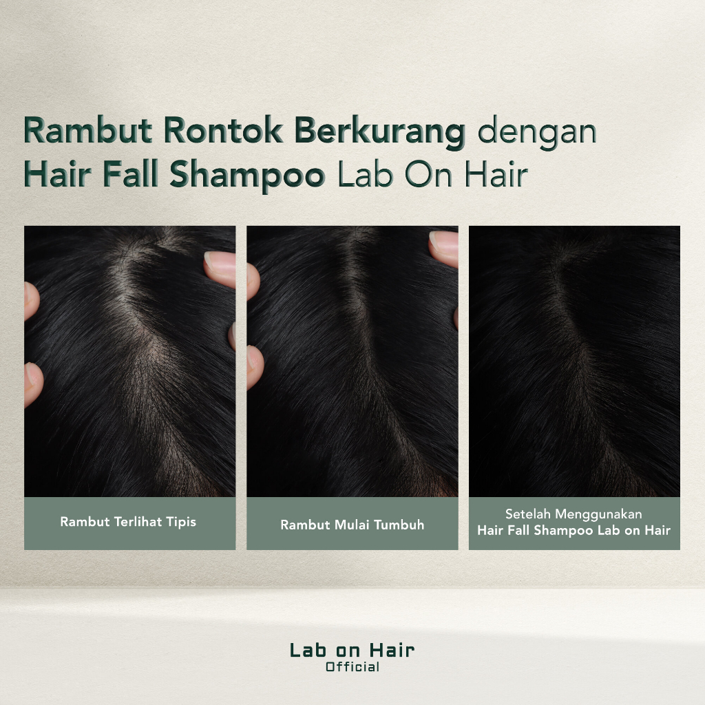 Jual Lab on Hair Bundle 2 Shampoo Anti Hair Fall Shampoo - Sampo ...