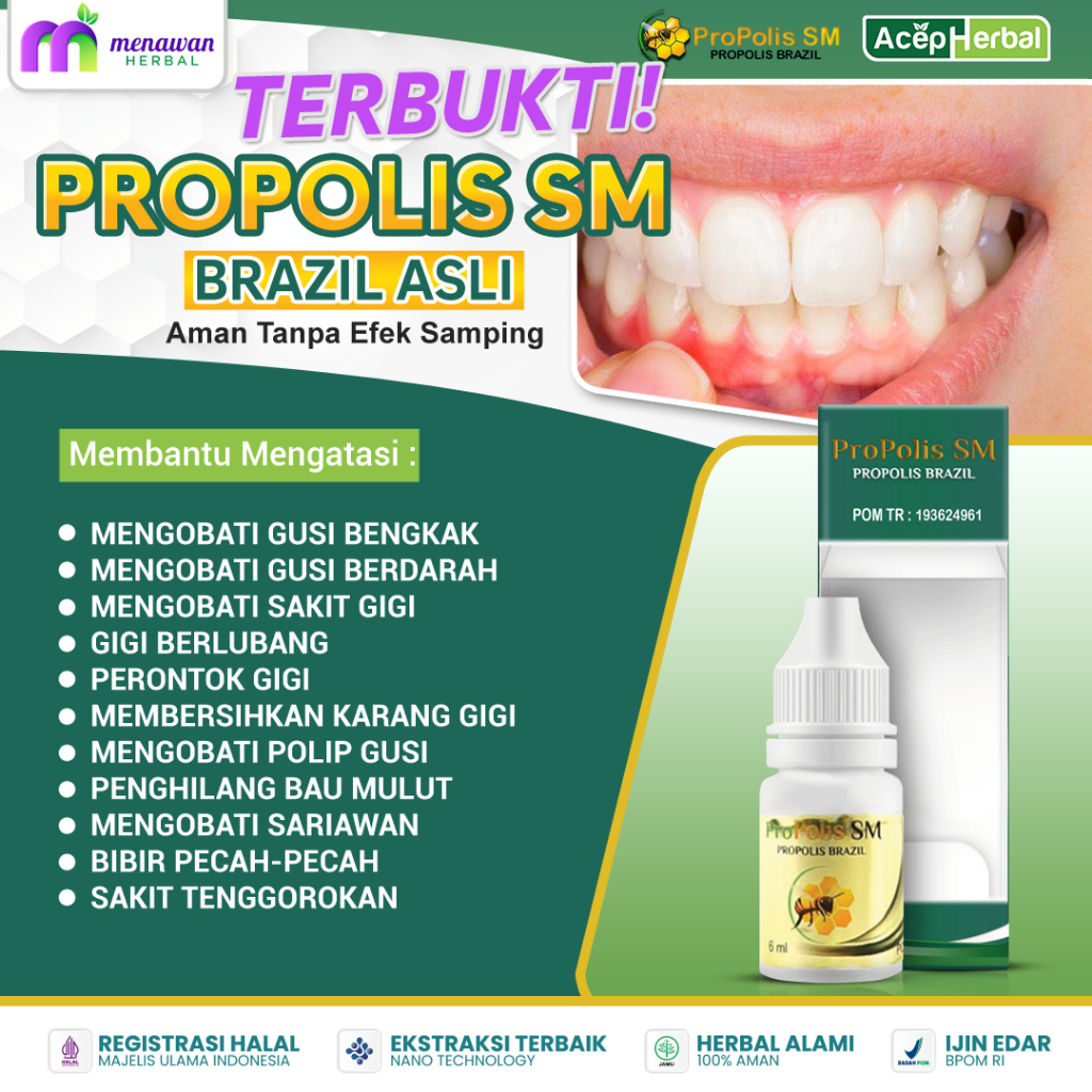 Jual Obat Gusi Bengkak Gusi Berdarah Gigi Berlubang Abses Gigi Gusi ...