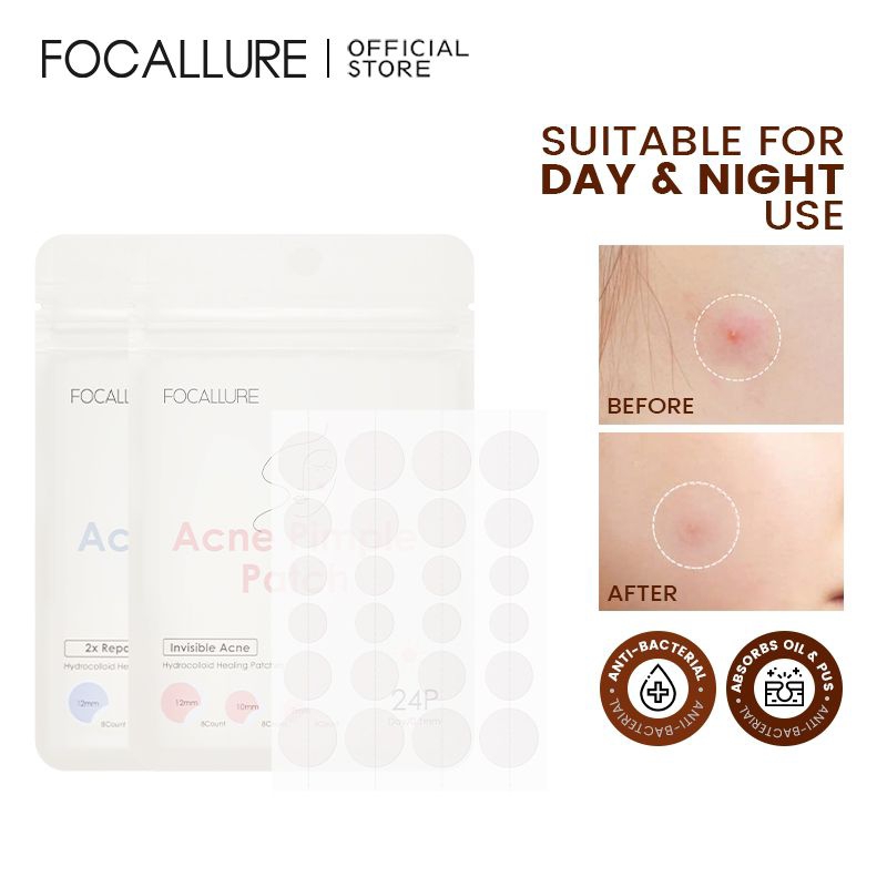 Jual Focallure Spot Pimple Patch Acne Treatment Day / Night 24 Patch ...