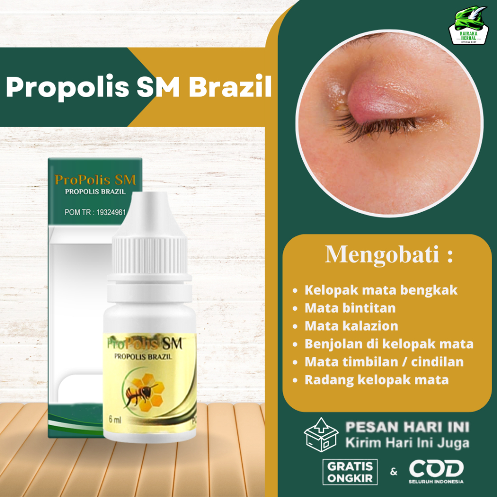Jual Obat Mata Bengkak Obat Mata Bintitan Obat Mata Kalazion Obat Mata ...