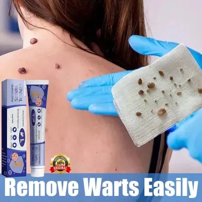Jual back Wart Drugs Warten Mole Cholesterol Mole Removal Wart Cream ...