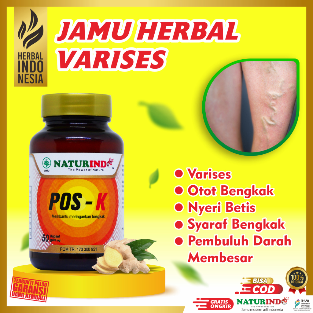 Jual Obat Varises Di Kaki Dan Betis Paling Ampuh Obat Varises Parises ...