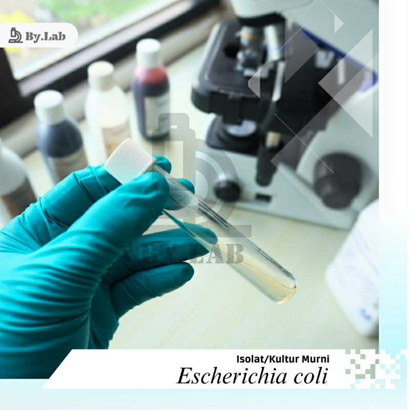 Jual Isolat/Kultur murni bakteri Escherichia coli (E.Coli) | Shopee ...