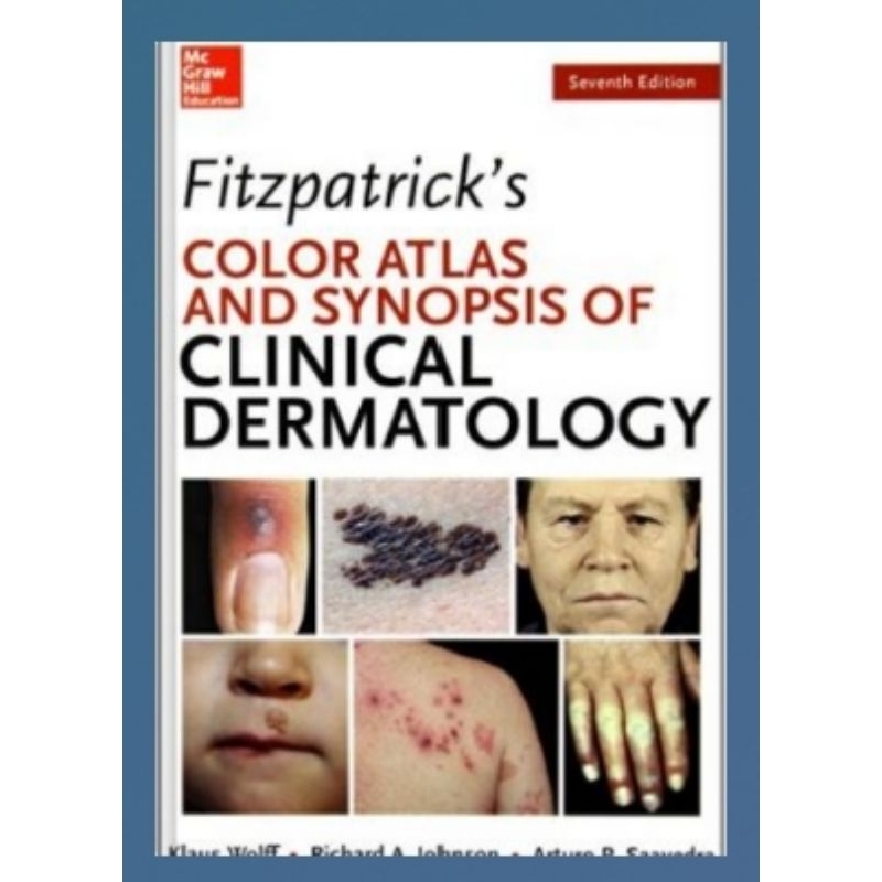 Jual Fitzpatrick's Color Atlas and Synopsis of Clinical Dermatology ...
