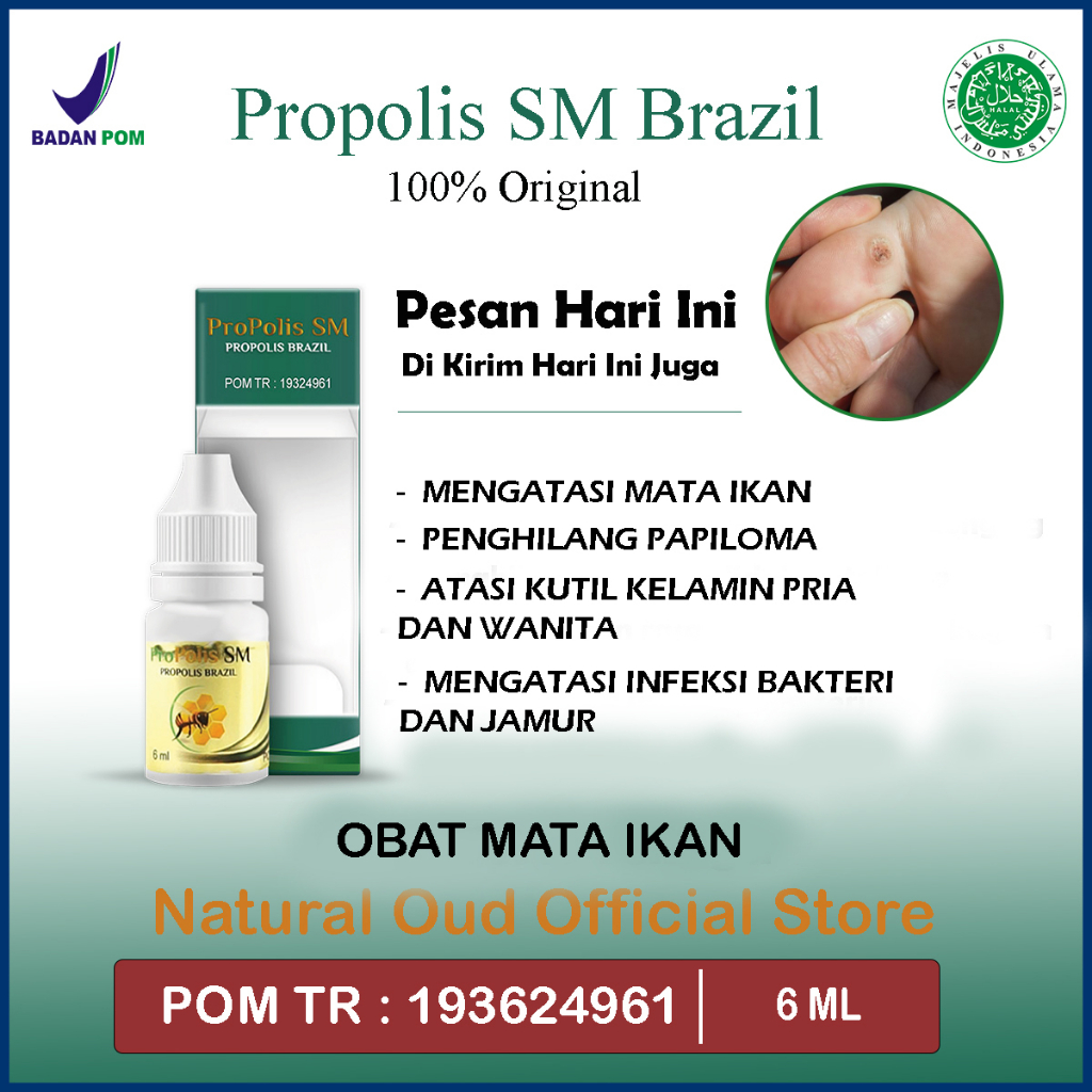 Jual Propolis Sm Brazil Original Obat Mata Ikan Kutil Di Telapak Kaki ...