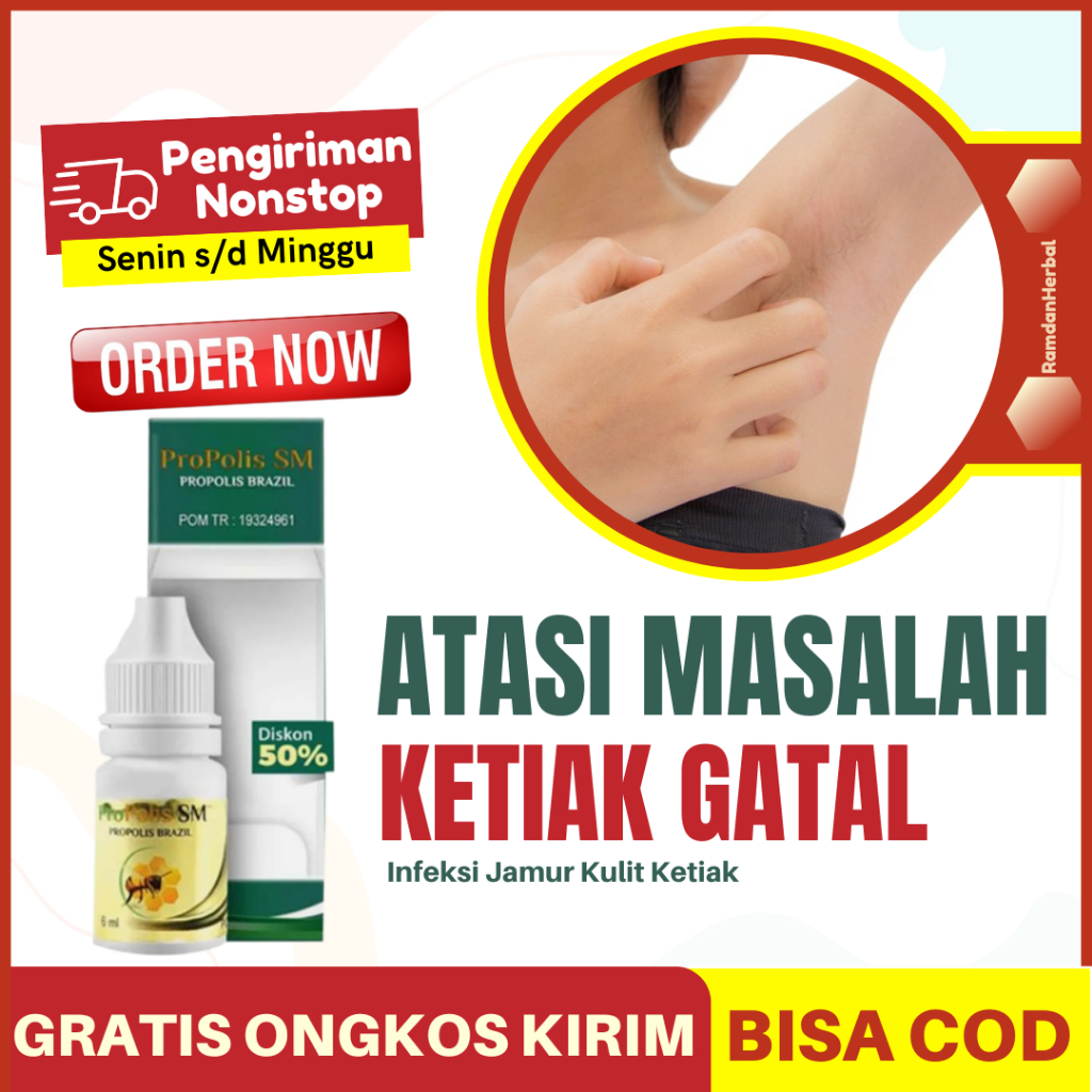 Jual Obat Ketiak Gatal Ketek Gatel Bintik Bintik Merah Ruam Infeksi ...