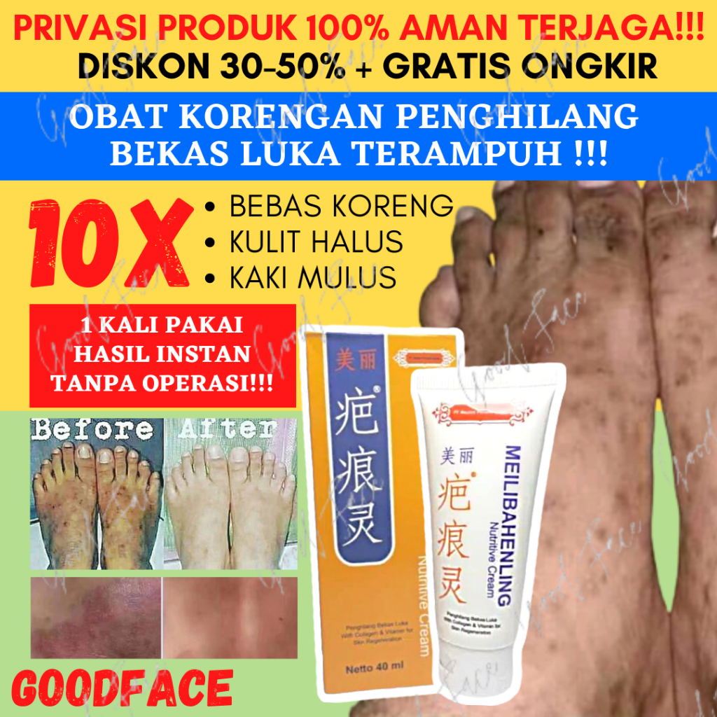 Jual PENGHILANG BEKAS LUKA AMPUH MEILIBAHENLING ORIGINAL BPOM ...