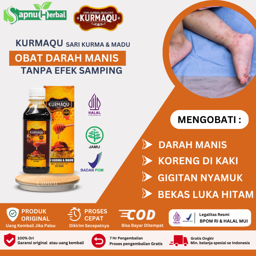 Jual Sapnu Herbal - Obat Darah Manis, Koreng Di Kaki, Gatal Amis Daging ...