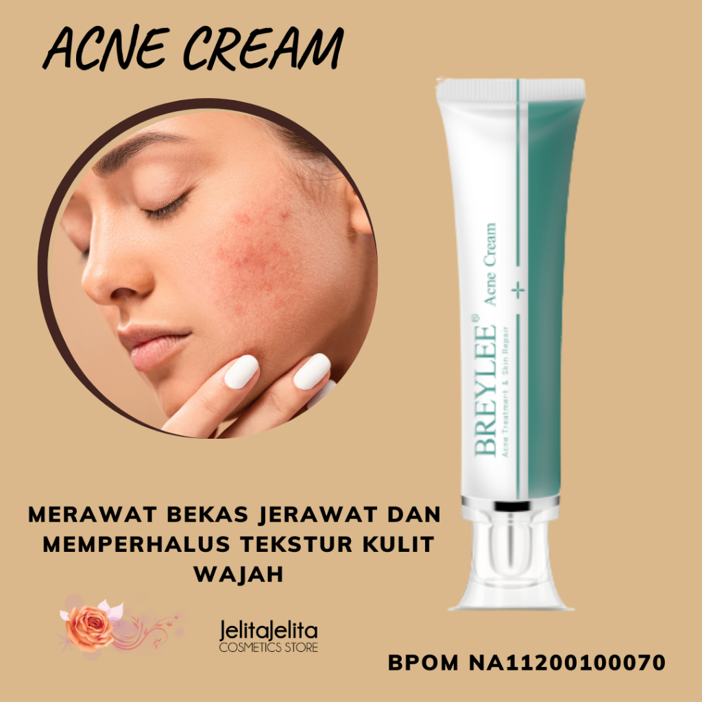 Jual Acne Cream Breylee Acne Scar Removal Bekas Jerawat dan Strechmark 30g | Shopee Indonesia