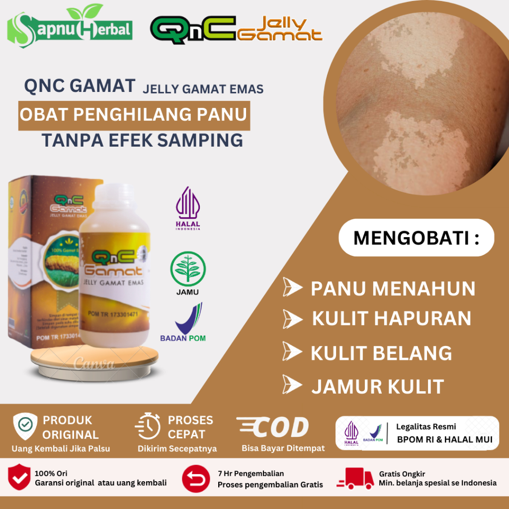 Jual Sapnu Herbal - Obat Panu Menahun, Menghilangkan Panu, Bercak Putih ...
