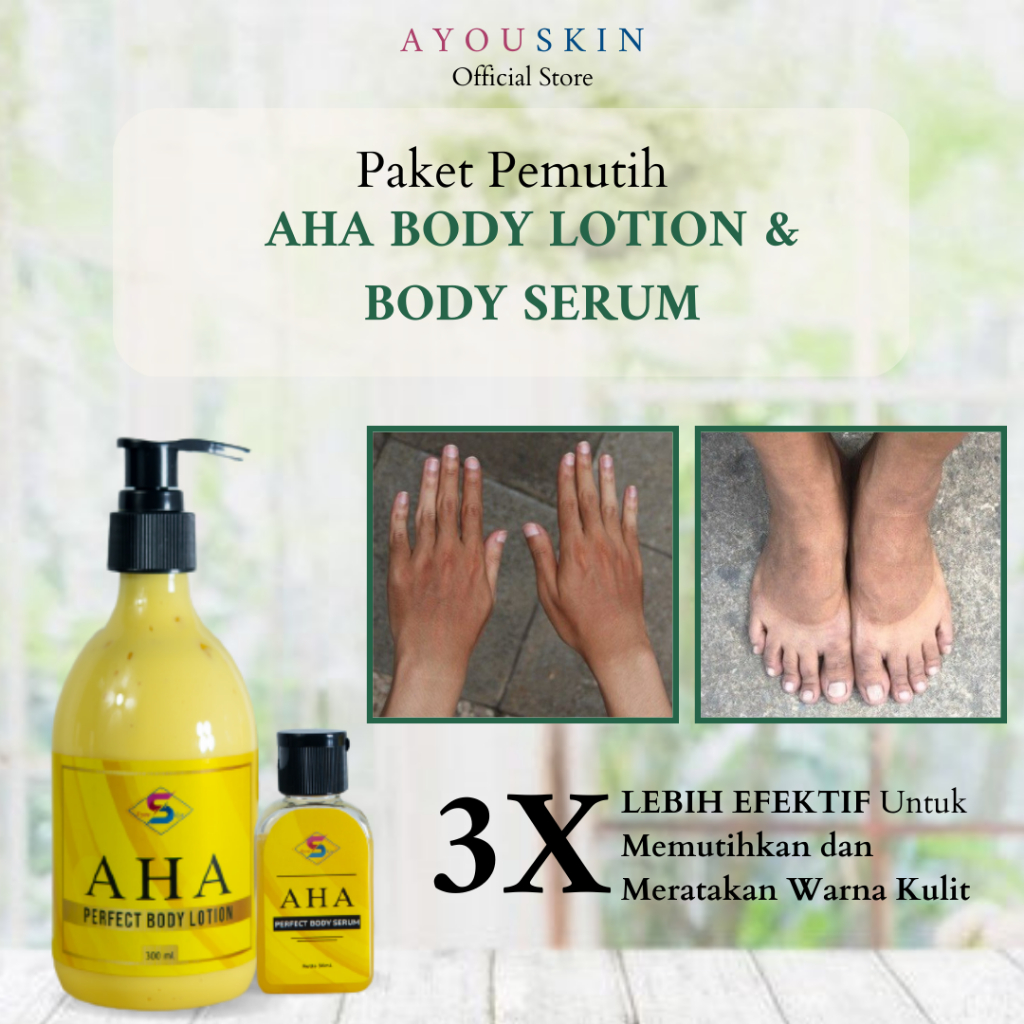 Jual Body Lotion Perawatan Tangan Dan Kaki Lotion Losion Pemutih