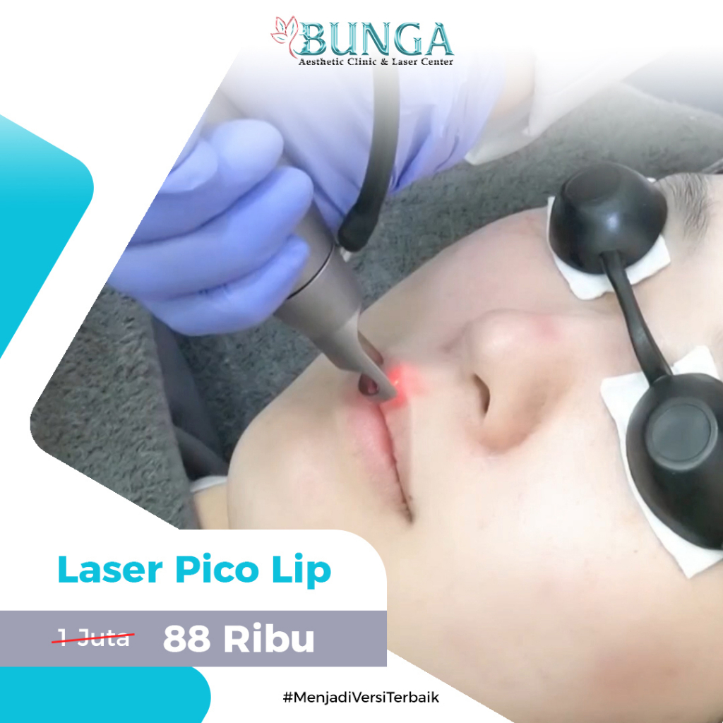 Jual LASER PICO LIP 1x - Voucher Treatment Bunga Aesthetic Clinic ...