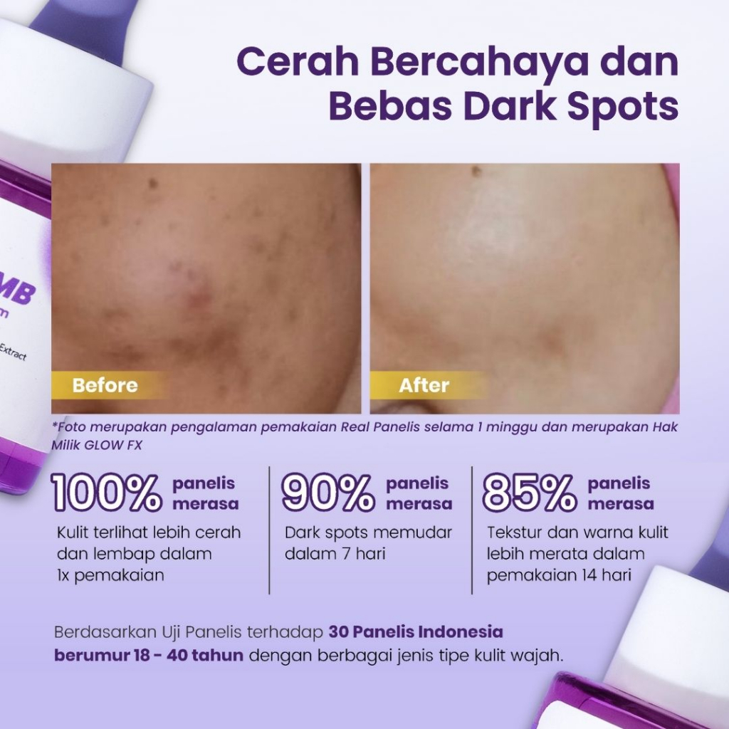 Jual GLOW FX Glow Bomb Serum - Serum Glowing & Bekas Jerawat 19% Brightening Power | Shopee ...
