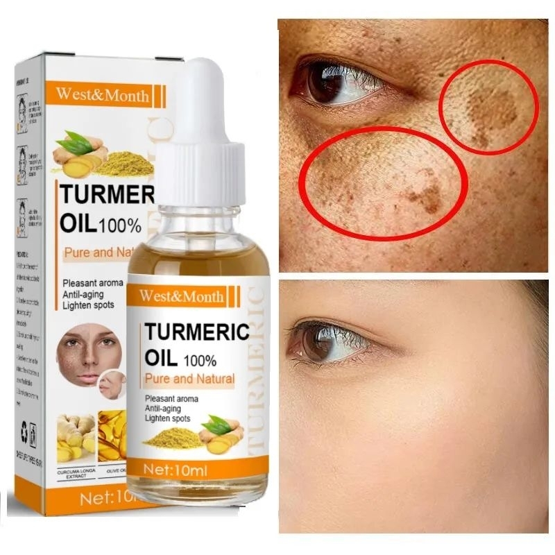 Jual tumeric oil dark spot | Shopee Indonesia