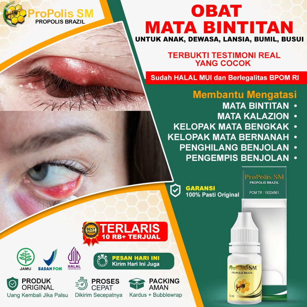 Jual Obat Mata Bintitan Obat Kelopak Mata Bengkak Obat Mata Kalazion ...