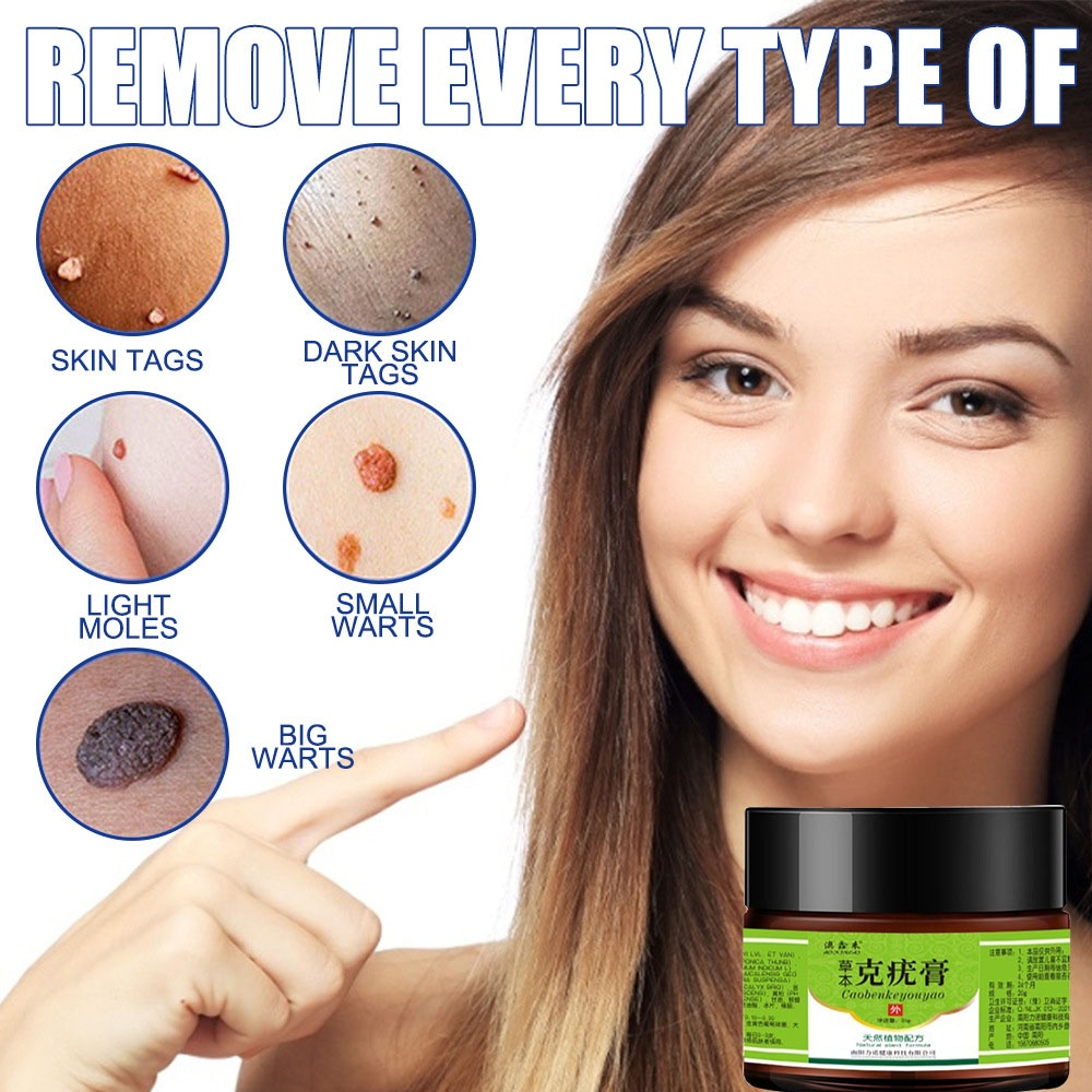 Jual penghilang tahi lalat Krim kutil obat penghilang kutil skin tag ...