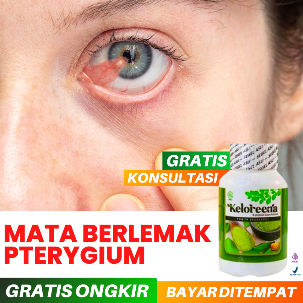 Jual Obat Mata Berlemak - Penghilang Lemak Di Mata - Pterygium - Keloreena Daun Kelor Asli 100% ...