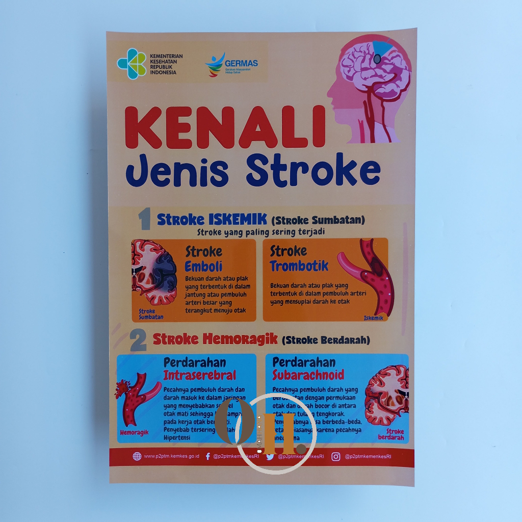 Jual Poster Kenali Jenis Stroke - PTM - Penyakit Stroke | Shopee Indonesia