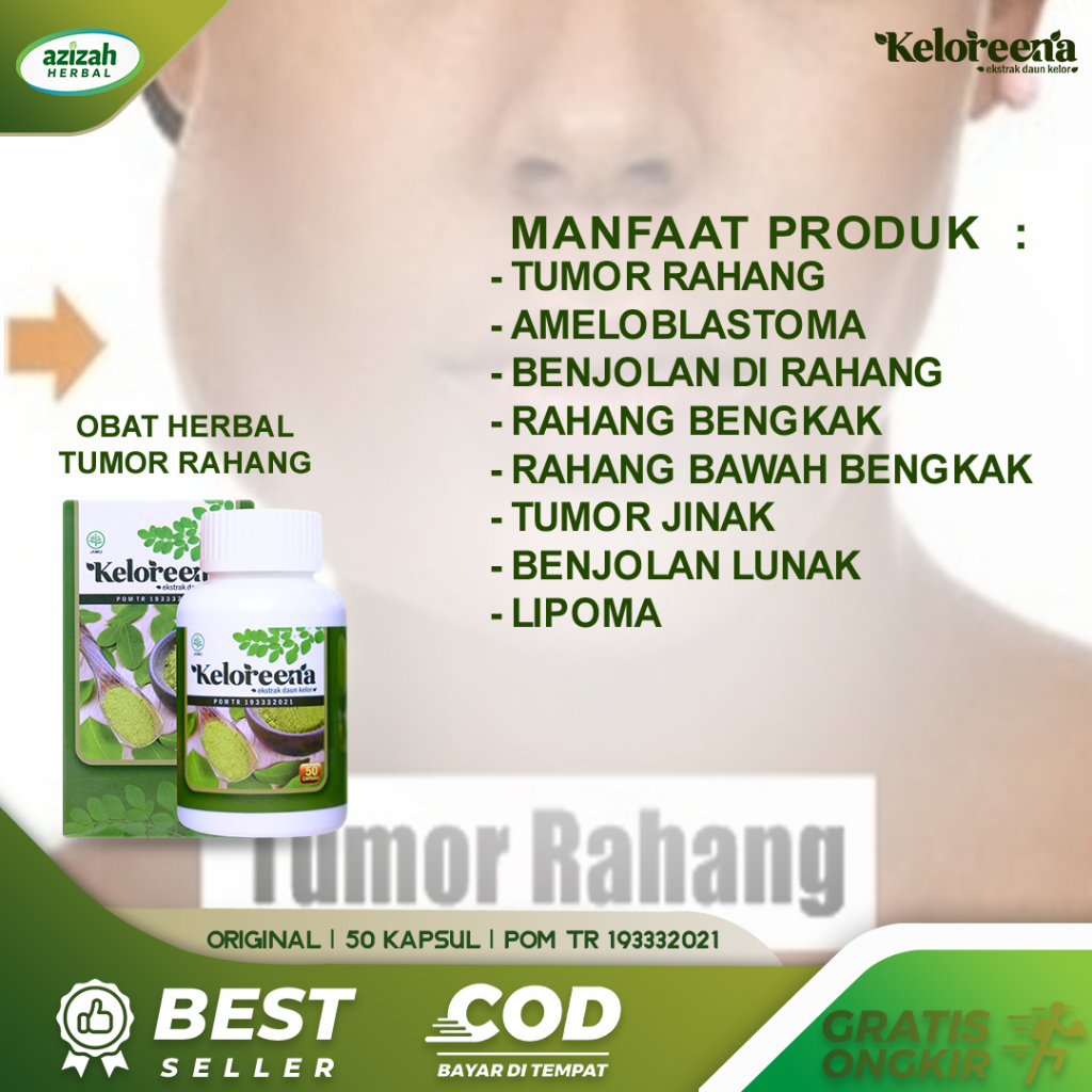 Jual Obat Tumor Rahang Ameloblastoma Benjolan Di Rahang Bawah ...