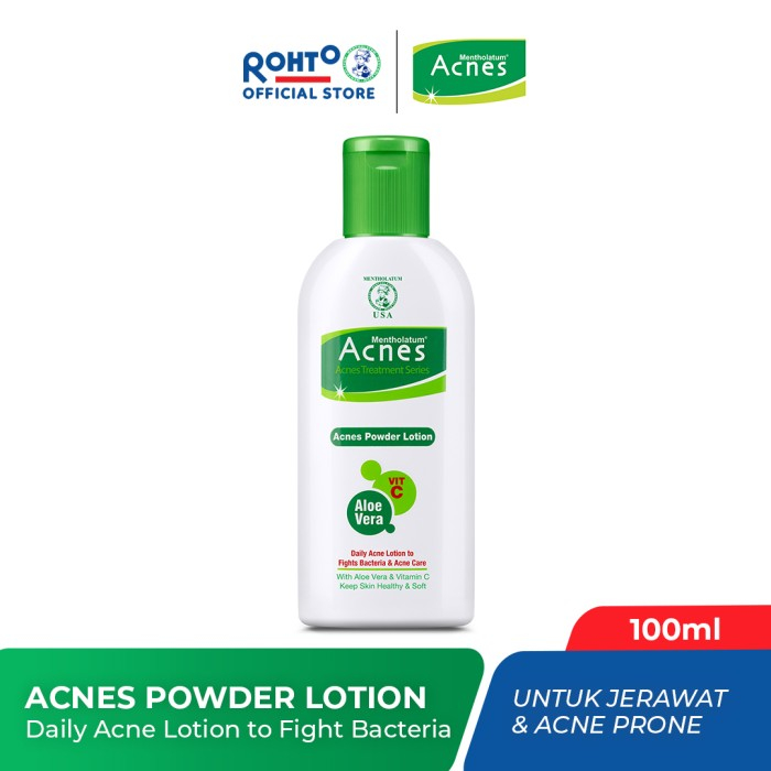 Jual ACNES Treatment Series Powder Lotion 100ml / Absorb Excess Sebum ...