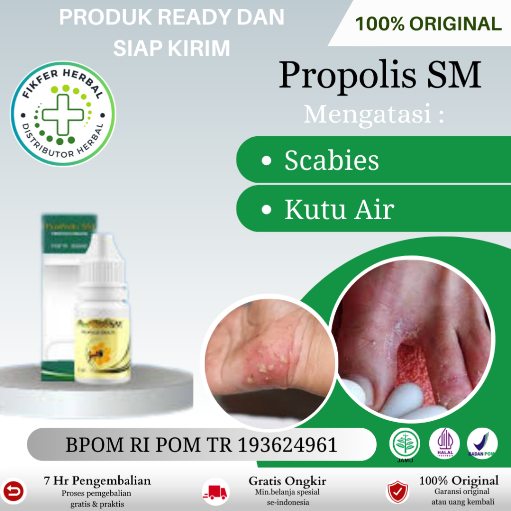 Jual Obat Scabies, Obat Kudis, Obat Kutu Air, Obat Kurap, Obat Bintik ...