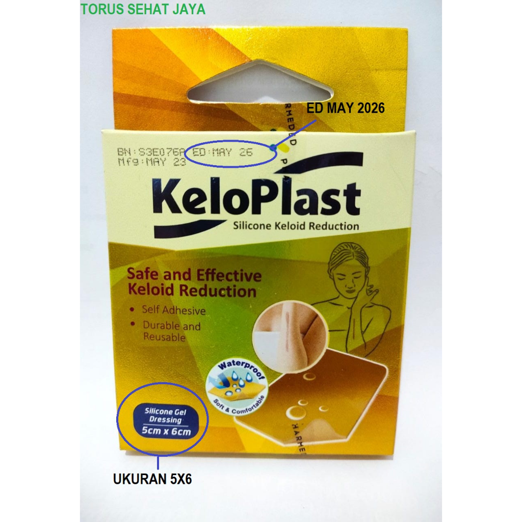 Jual Keloplast Silicon Keloid Reduction 5x6 Penghilang keloid Bekas ...